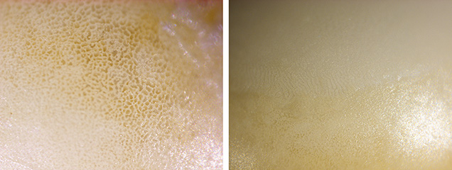 Calcite Present in a Pearl from Pinctada maculata