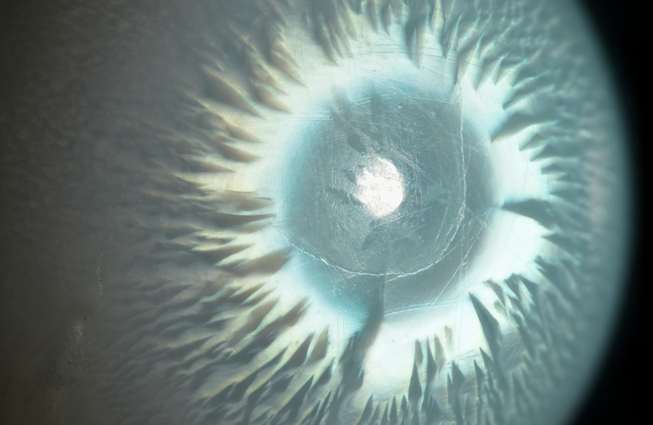 An “Eye” on a Tridacninae Pearl